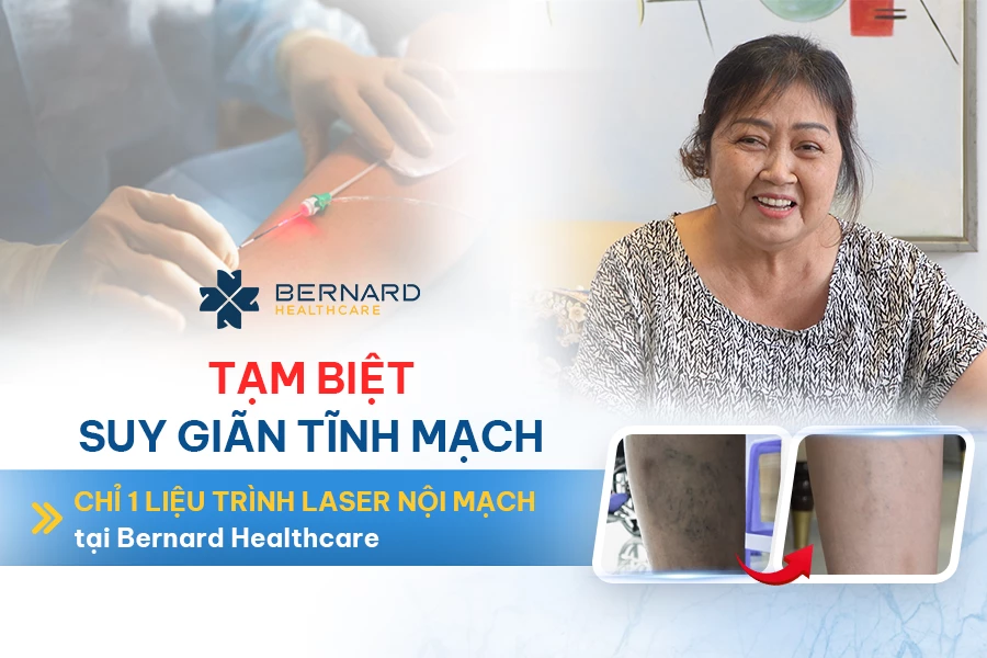 SUY GIÃN TĨNH MẠCH MỨC ĐỘ C4 CÔ KHÁCH LẤY LẠI ĐÔI CHÂN KHỎE CHỈ 1 LẦN THỰC HIỆN LASER NỘI MẠCH